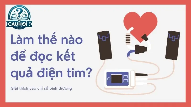 Kết quả điện tim như thế nào là bình thường? Làm thế nào để đọc kết quả ...